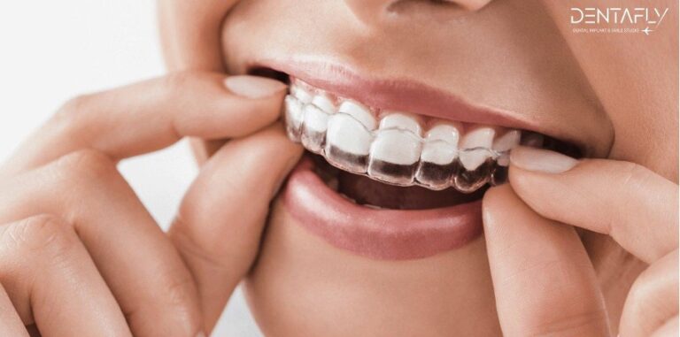 Gece Plağı - Dentafly